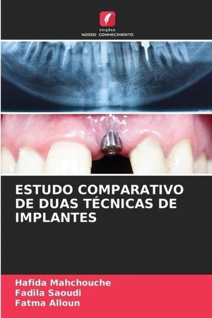 ESTUDO COMPARATIVO DE DUAS TÉCNICAS DE IMPLANTES Hafida Mahchouche (u ...