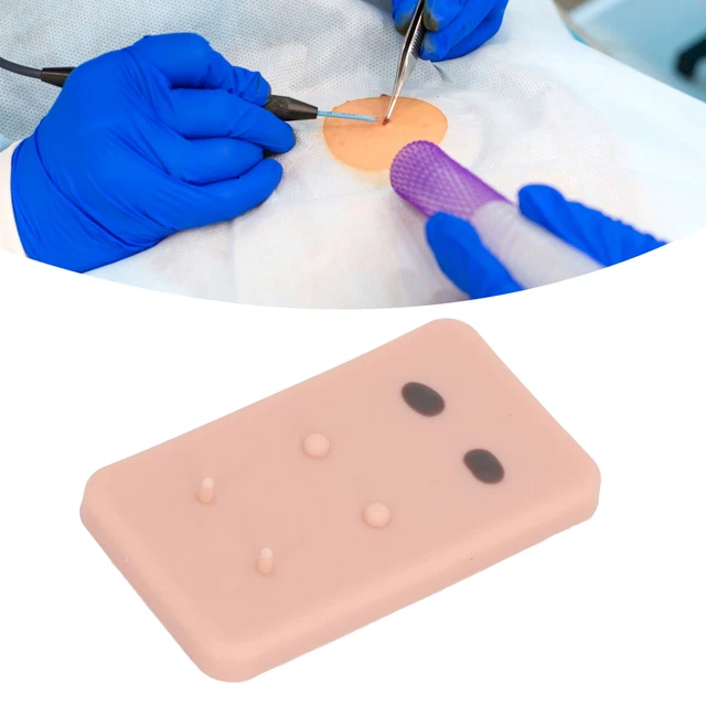 SKIN TAG NEVUS Seborrheic Keratosis Module Epidermal Disease Silicone ...