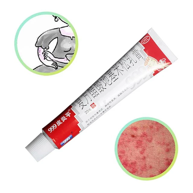 20G 999 PI Yan Ping Ointment Cream Anti-Inflammatory for Skin Itch ...