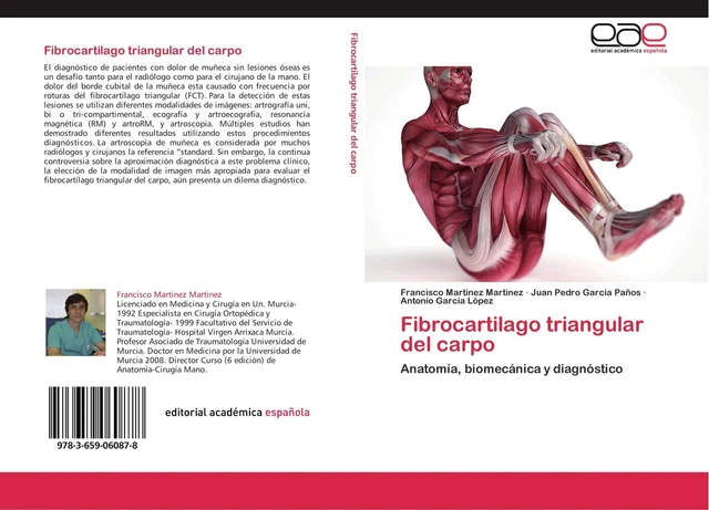 FIBROCARTILAGO TRIANGULAR DEL carpo Anatomía, biomecánica y diagnóstico ...