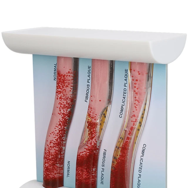 Blood Typing Kit The Low-density Lipoprotein (LDL) Complex Is The ...