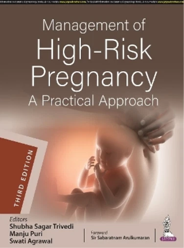 SWATI AGRAWAL SHUBHA Sagar Trivedi Manj Management of High-Risk Pre ...
