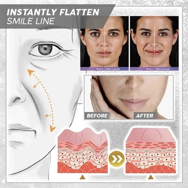 ANTI-AGING MASK ANTI-WRINKLE Stickers Anti-wrinkle patch Nasolabial ...