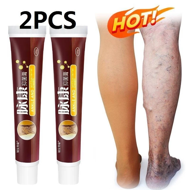 2PCS VARICES MEDICAL Cream Testicular Varicocele Ointment Treatment Leg ...