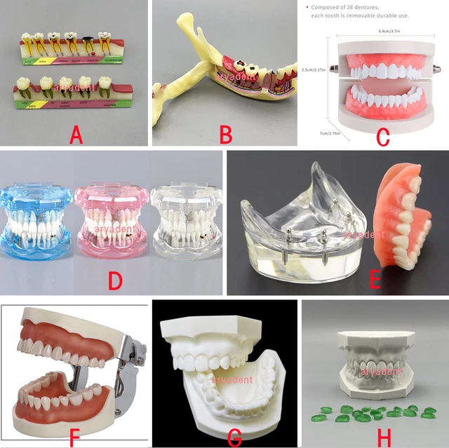 DENTAL IMPLANT MODEL Teeth Caries Disease Teaching Analysis Study ...