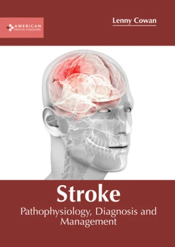 STROKE: PATHOPHYSIOLOGY, DIAGNOSIS and Management by Lenny Cowan ...