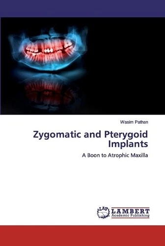 WASIM PATHAN ZYGOMATIC and Pterygoid Implants (Poche) EUR 74,01 ...