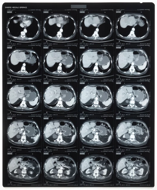 GENUINE VINTAGE HOSPITAL Human X-Ray CT Scan Tomography Original ...