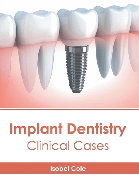 IMPLANT DENTISTRY: CLINICAL Cases by Isobel Cole Hardcover Book EUR 181 ...