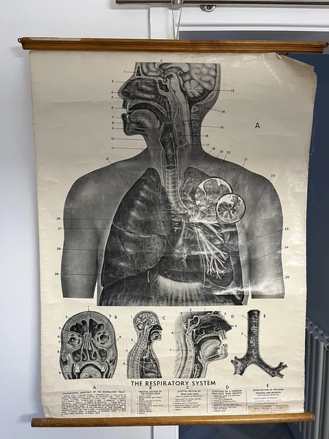 ANTIQUE VINTAGE ADAM Rouilly Wall Chart Poster Medical Respiratory ...