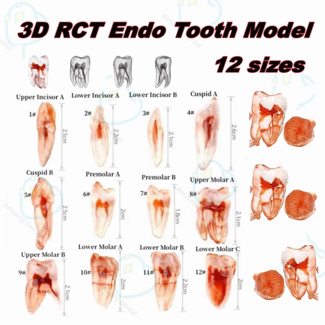 DENTAL RCT 3D Print Endo Training Model Block Practice Replicas Root ...