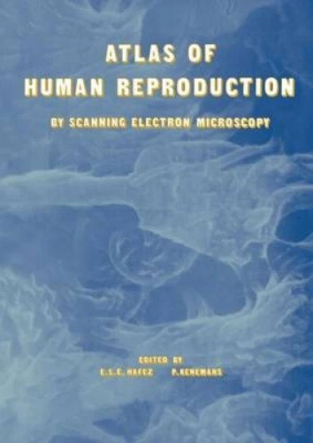ATLAS OF HUMAN Reproduction: By Scanning Electron Microscopy $259.00 ...