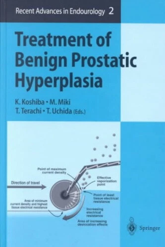 TREATMENT OF BENIGN Prostatic Hyperplasia (Recent Advances in ...