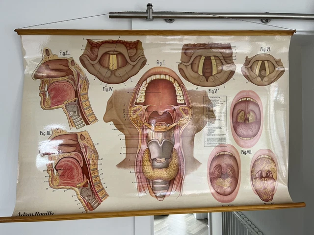 ANTIQUE VINTAGE ADAM Rouilly Wall Chart Poster Medical Throat £94.95 ...