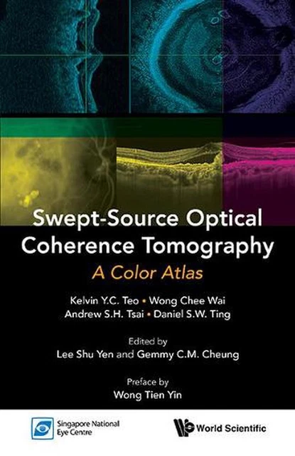 SWEPT-SOURCE OPTICAL COHERENCE Tomography: A Color Atlas by Kelvin Yi ...