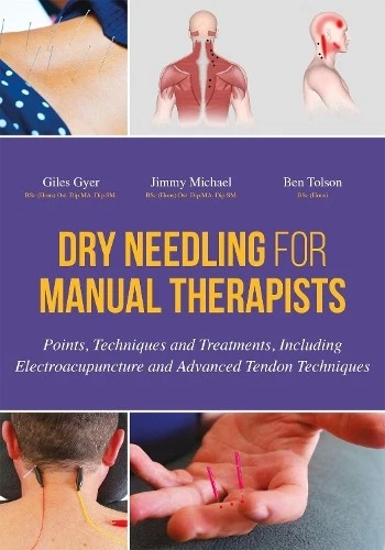 BEN TOLSON GILES Gyer Jimmy Michae Dry Needling for Manual Therapist ...