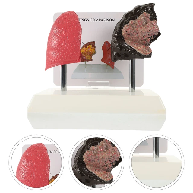 LUNG STRUCTURE MOLD Smokers School Respiratory Model Anatomy £37.48 ...