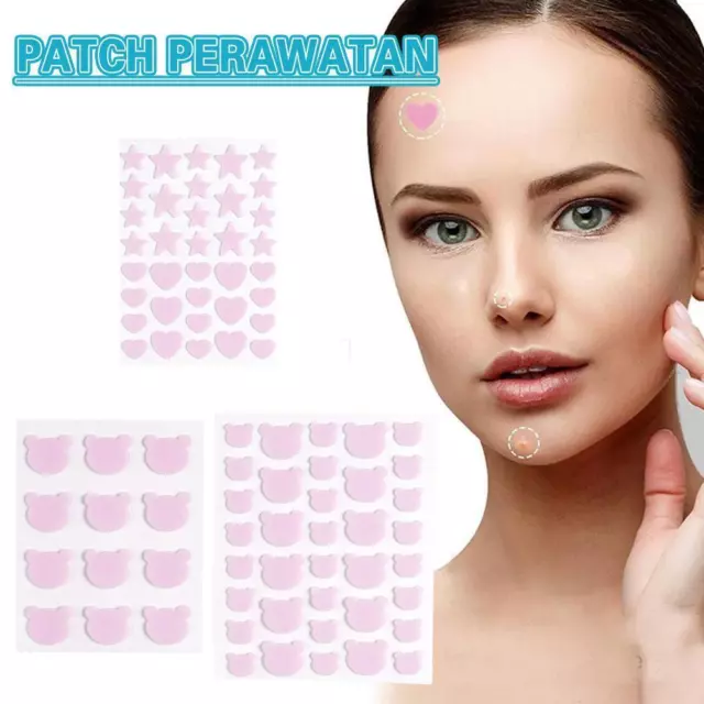 WATERPROOF ACNE PIMPLE Patches Hydrocolloid Sticker Pimples Removal ... WATERPROOF ACNE PIMPLE Patches Hydrocolloid Sticker Pimples Removal ...