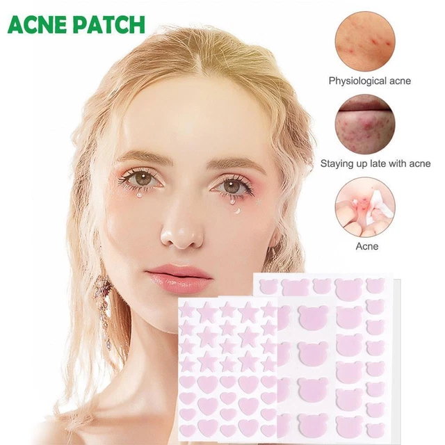 WATERPROOF ACNE PIMPLE Patches Hydrocolloid Sticker Pimples Removal ... WATERPROOF ACNE PIMPLE Patches Hydrocolloid Sticker Pimples Removal ...