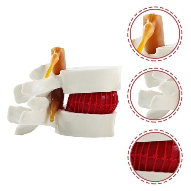 LUMBAR VERTEBRAE 3D Model Anatomy for Chiropractor Intervertebral Disc ...