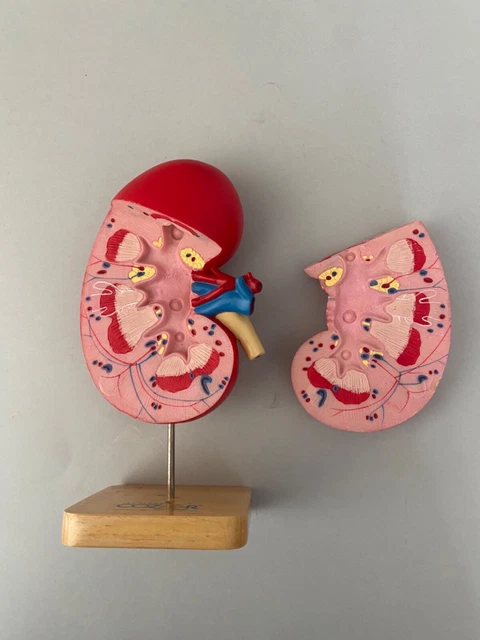 MAQUETTE ANATOMIQUE COUPE D'un Rein Humain Publicitaire Cozaar EUR 75 ...