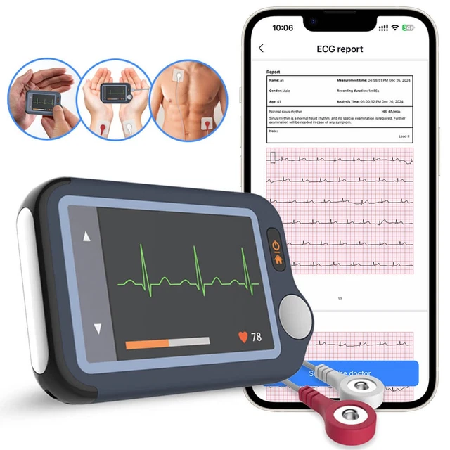 MOBILE ECG EKG Heart Monitor - Smartphone compatible AI ECG analysis ...