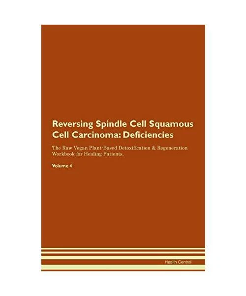 REVERSING SPINDLE CELL Squamous Cell Carcinoma: Deficiencies The Raw ...