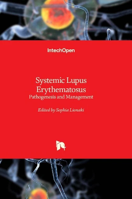 SYSTEMIC LUPUS ERYTHEMATOSUS: Pathogenesis and Management by Sophia ...