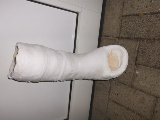 GIPSBEIN (ECHTGIPS) MIT Gehstollen EUR 30,00 - PicClick DE