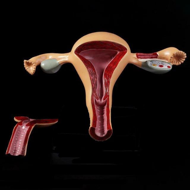 PATHOLOGICAL AND NORMAL Uterus Ovary Model Anatomical Anatomy Disease ...