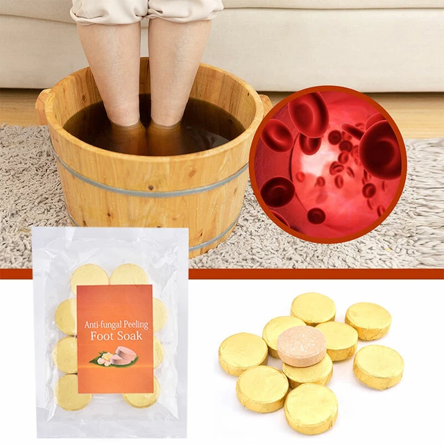 ANTI-FUNGAL FOOT BATH Tablet Fungal Infections Sweat Itching Beriberi ...