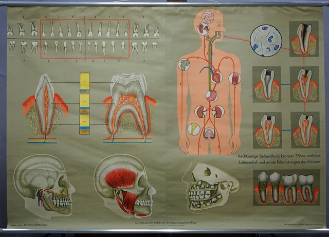 AFFICHE CORPS HUMAIN tableau mural ATM muscles dents saines mâchoire ...