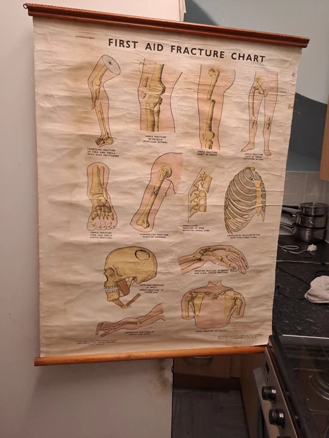 FIRST AID FRACTURE Vintage Chart - By Adam Rouilly & Co London £69.50 ...