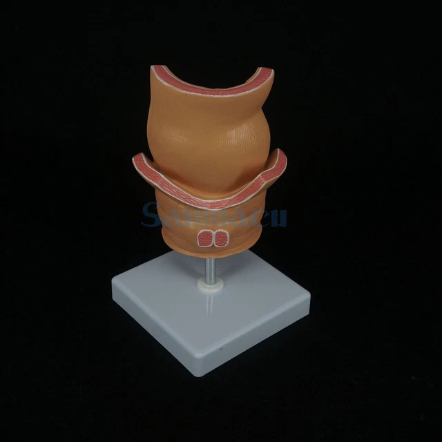 ANATOMICAL HUMAN RECTUM Pathology Lesion Model Hemorrhoids Anus Medical ...