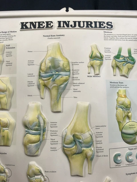 VINTAGE ANATOMICAL “KNEE Injuries” Medical Chart 3D Poster Rare £29.99 ...