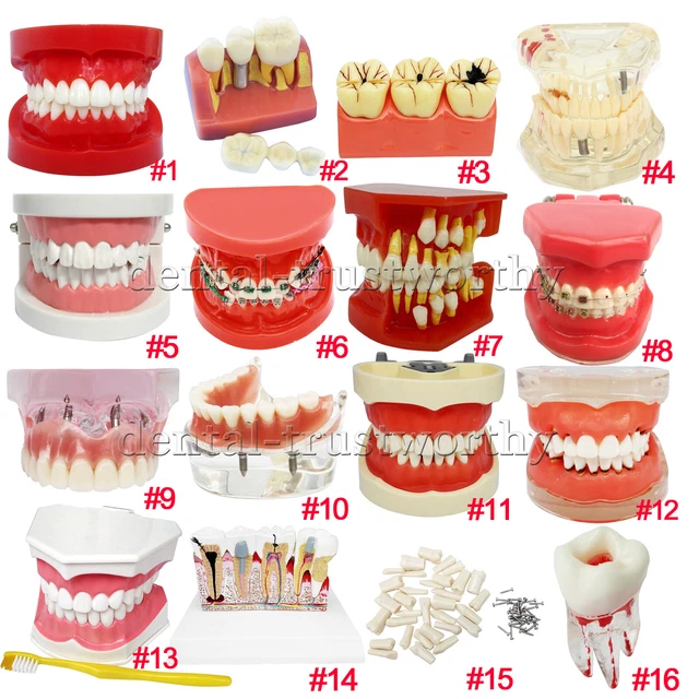 DENTAL ORTHODONTICS IMPLANT Study Analysis Demonstration Teaching Tooth ...