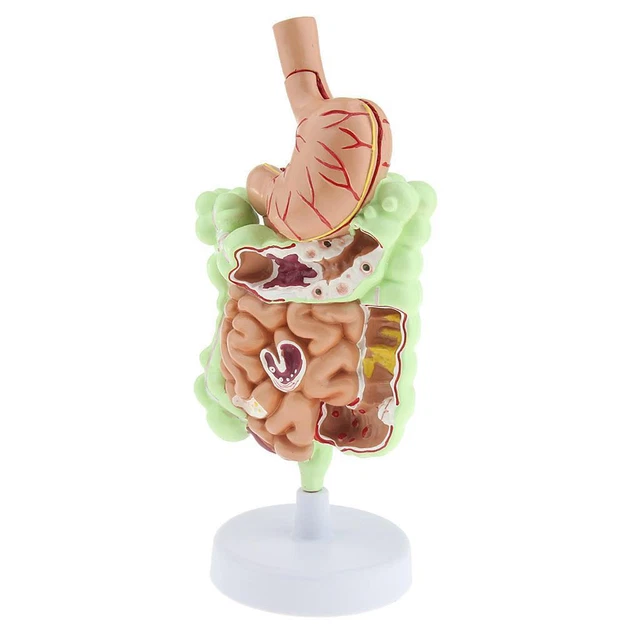 ANATOMY OF HUMAN Digestive System Stomach Gastrointestinal Model £35.46 ...