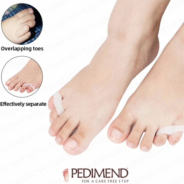 SMALL TOE CORRECTOR Little Toe Finger Hallux Valgus Corrector ...