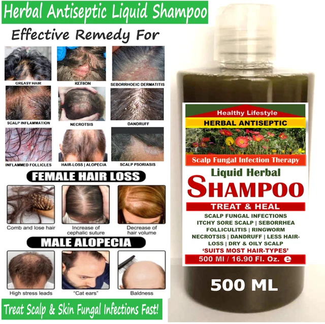 RINGWORM LICHEN PLANUS Cellulitis Warts - ANTISEPTIC HERBAL SHAMPOO 500 ...