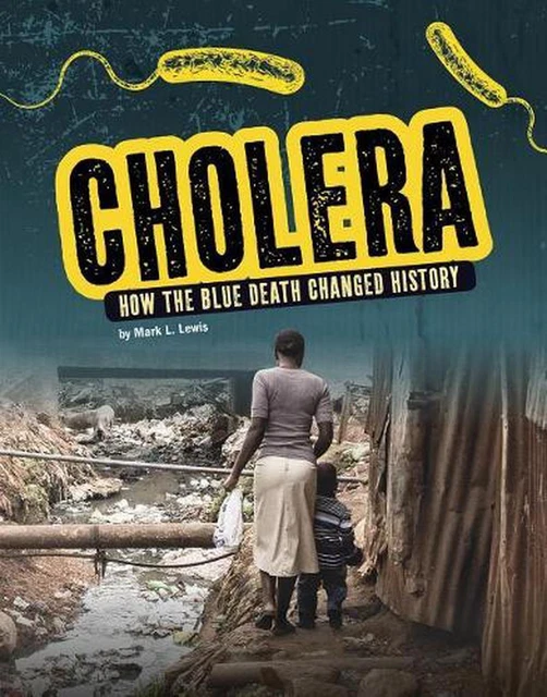 CHOLERA: HOW THE Blue Death Changed History by Mark L. Lewis (English ...