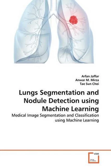 Lungs Segmentation And Nodule Detection Using Machine Learning Medical Image Se Eur 92 27