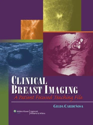 Clinical Breast Imaging A Patient Focused Teaching File Radiology