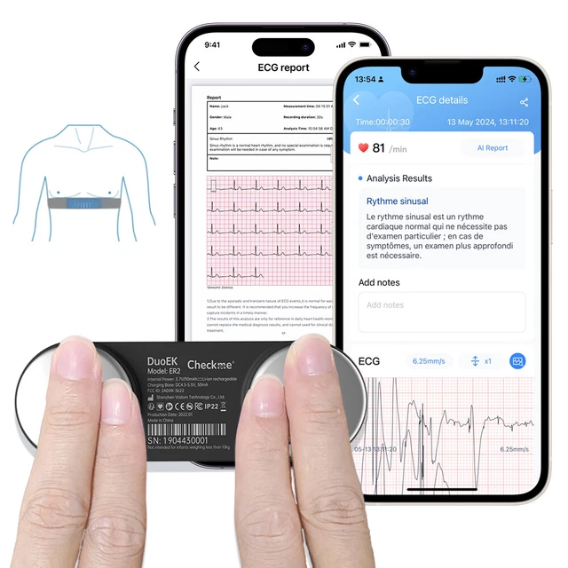 COST-EFFECTIVE MOBILE ECG EKG Heart Monitor+AI ECG analysis via app Detect AFib £59.99 - PicClick UK