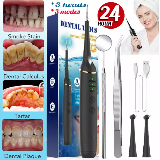 ELECTRIC SONIC DENTAL Scaler Tartar Plaque Calculus Remover Teeth ...