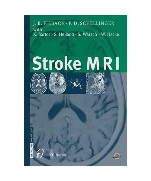 STROKE MRI, PETER Schellinger, Jochen Fiebach EUR 39,94 - PicClick FR STROKE MRI, PETER Schellinger, Jochen Fiebach EUR 39,94 - PicClick FR