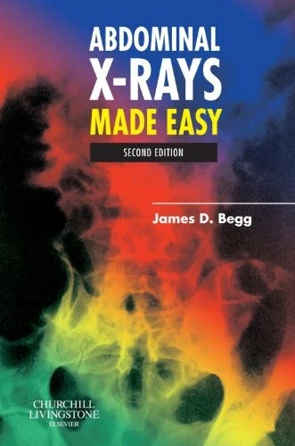 ABDOMINAL X-RAYS MADE Easy, Begg, Dr. James D. £4.49 - PicClick UK