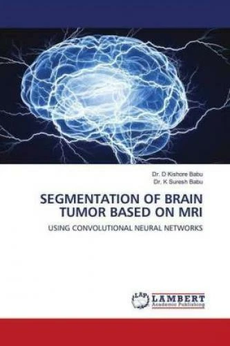 Segmentation Of Brain Tumor Based On Mri Using Convolutional Neural