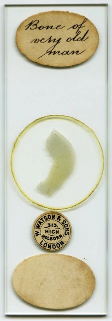 ANTIQUE MICROSCOPE SLIDE of Bone of Very Old Man by Watson £11.09 ...