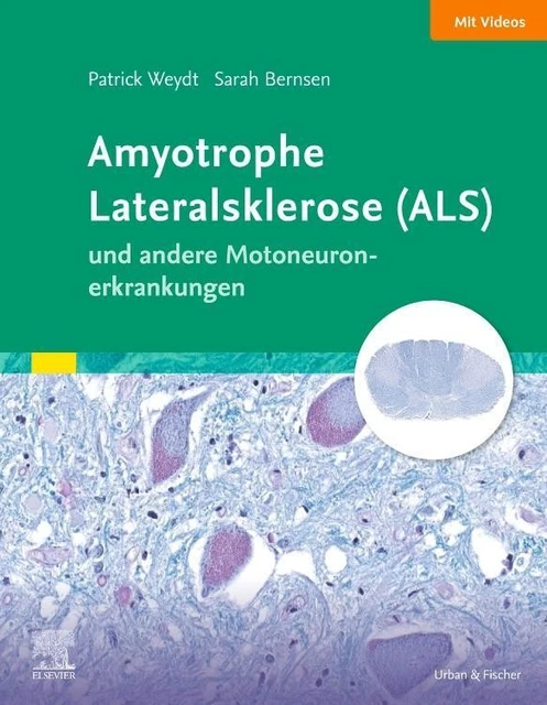 PATRICK WEYDT / Amyotrophe Lateralsklerose (ALS) und andere Mo ...
