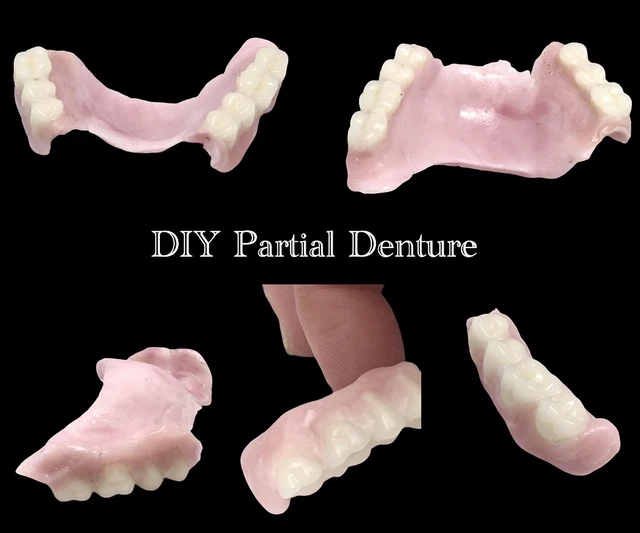 DIY PARTIAL DENTURE Kit_Partial Denture_DIY Denture Bridge_Replacement ...